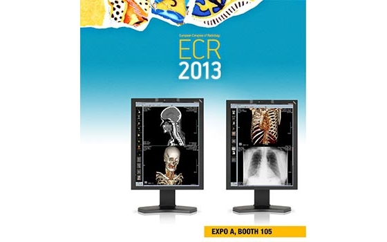 NEC zeigt neue medizinische Displaylösungen auf dem ECR 2013 - Prad.de